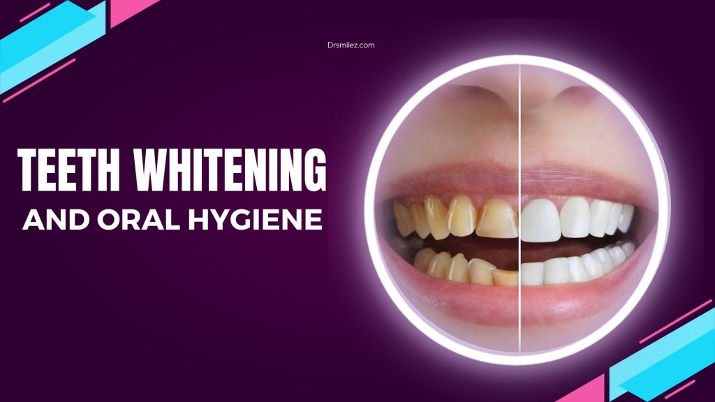 Types of Teeth Whitening Treatment and Benefits | GuestCanPost