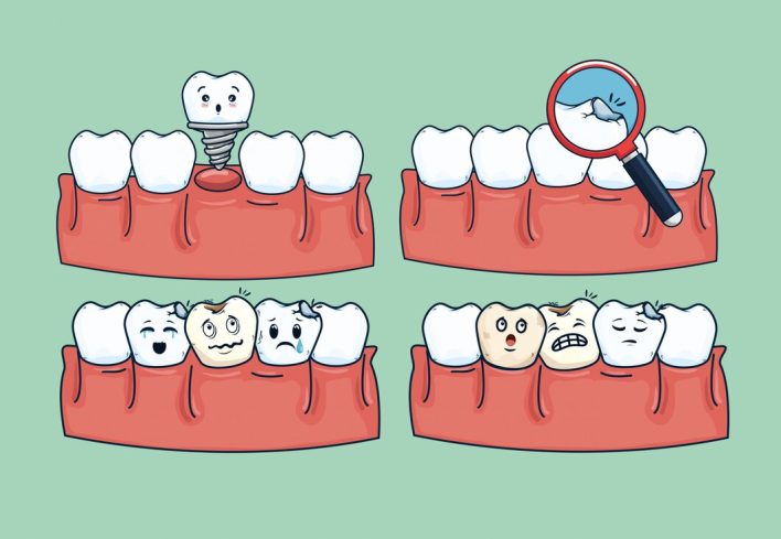 Living with a Missing Tooth: Health Consequences You Should Know